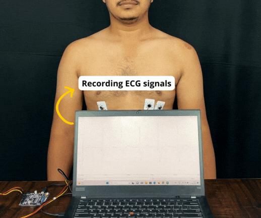Record Publication Grade ECG at Your Home Using BioAmp EXG Pill : 9 ...