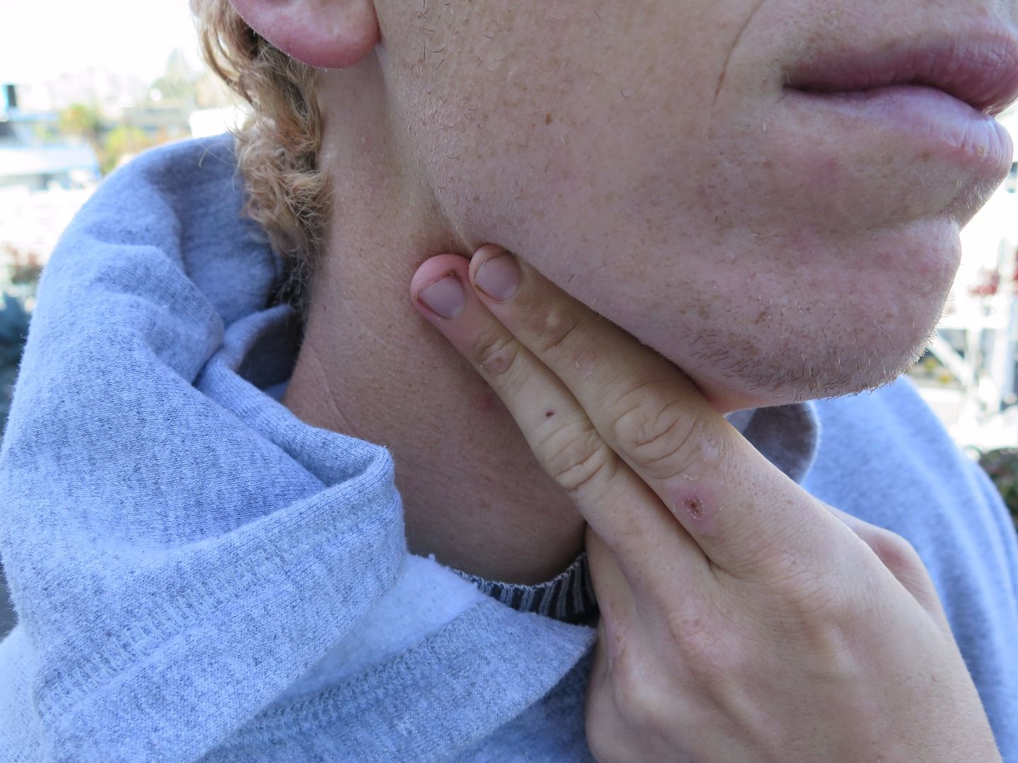 Heart Dissection : 8 Steps (with Pictures) - Instructables