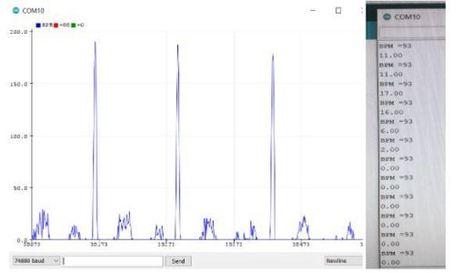 ECG Project- Extra Credit BME 305 Final Design Project : 8 Steps - Instructables