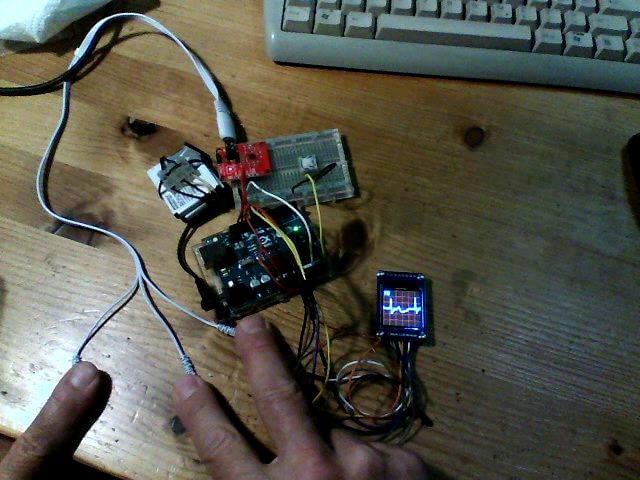 ECG Display With Arduino : 13 Steps (with Pictures) - Instructables