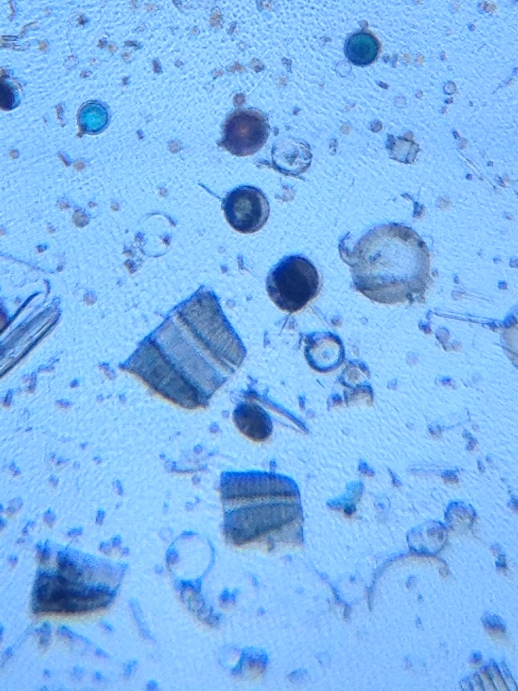 $10 Smartphone to Digital Microscope Conversion! : 9 Steps (with ...
