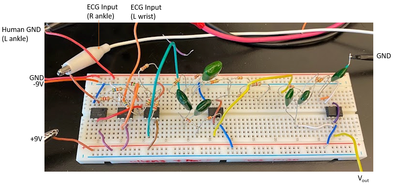 Designing an ECG : 6 Steps - Instructables