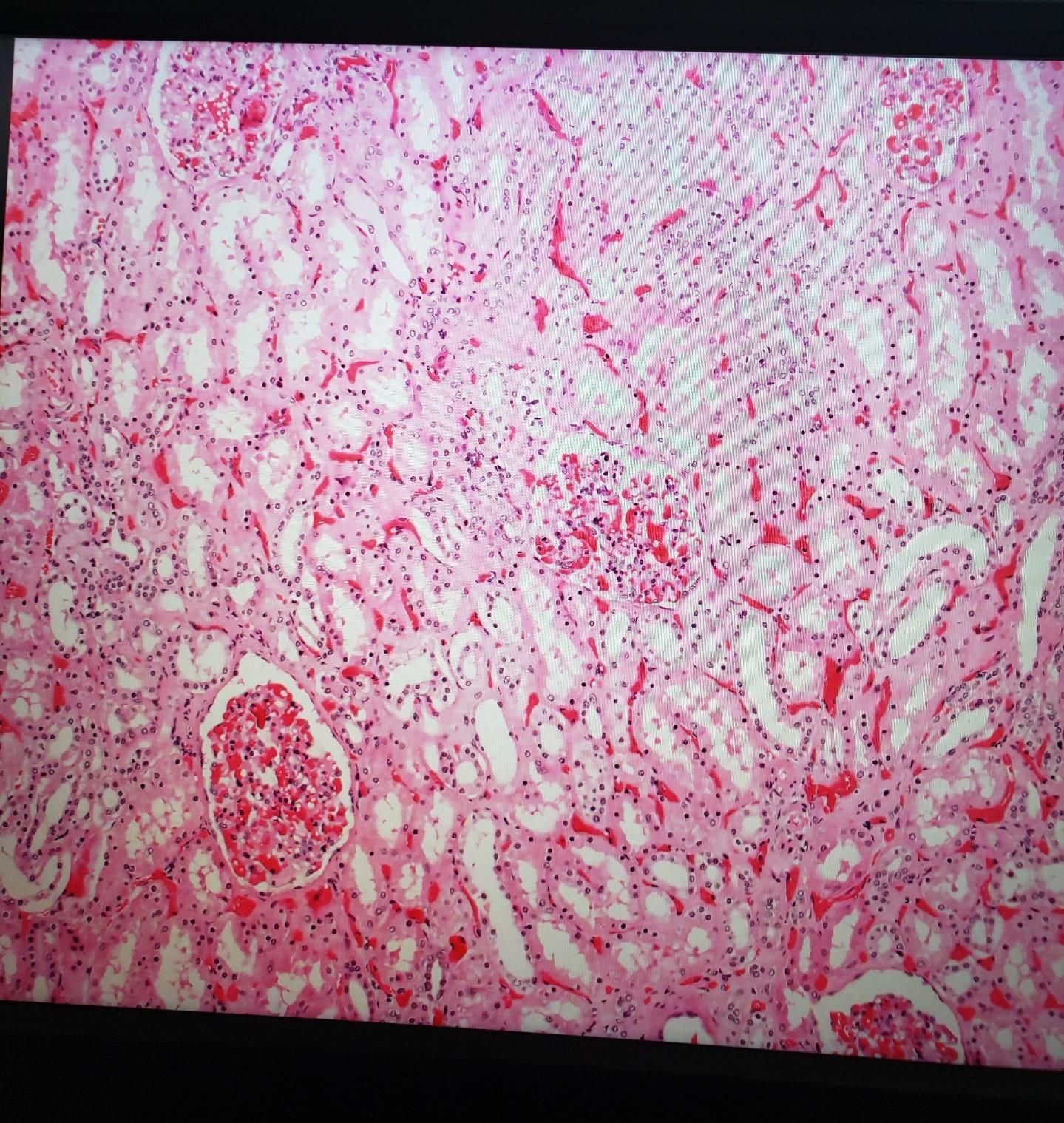 How to Change a Leica and Thermo Stainer : 25 Steps - Instructables