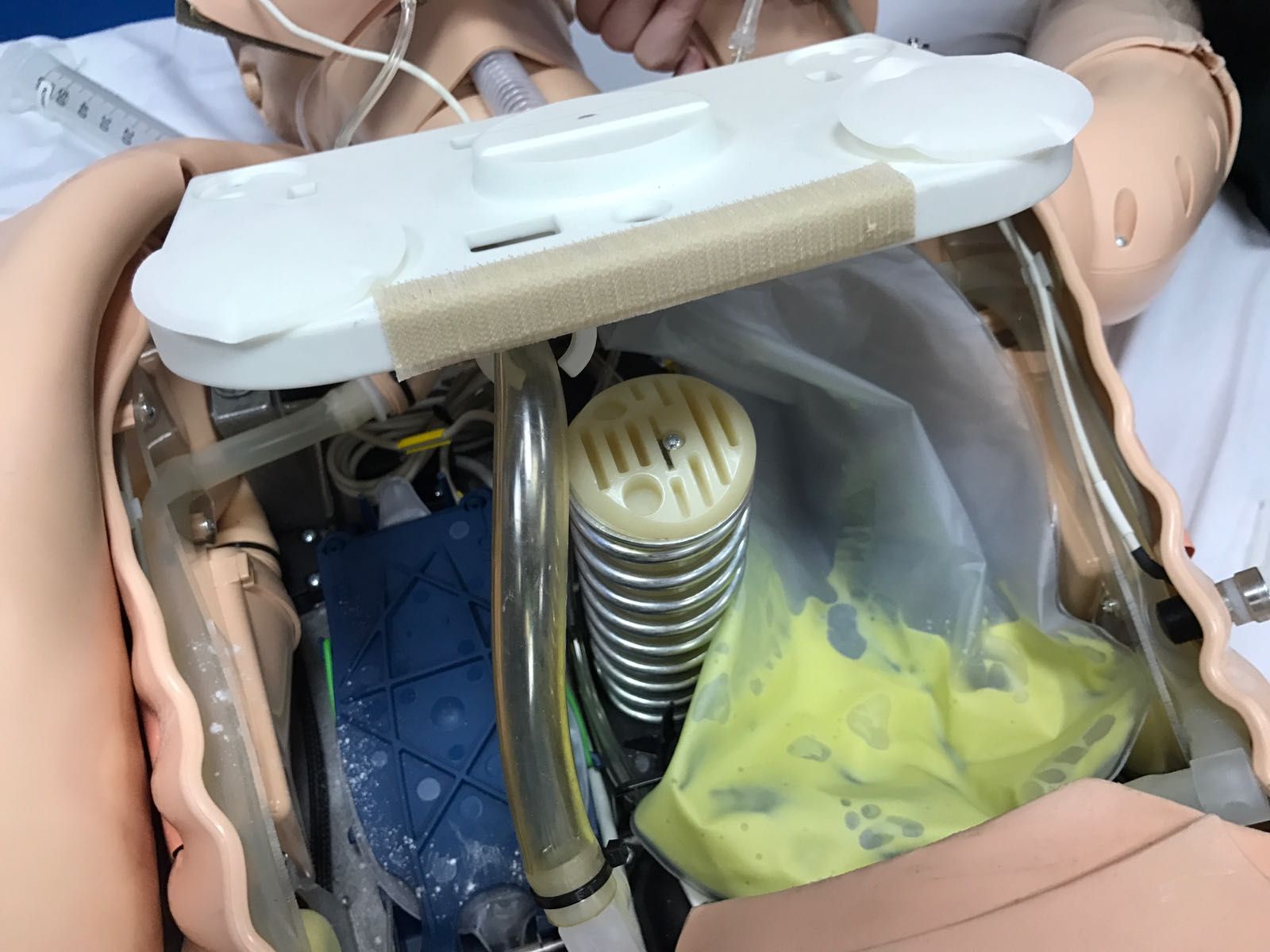 Converting Your Simulation Manikin for Tracheostomy Suctioning : 3 ...