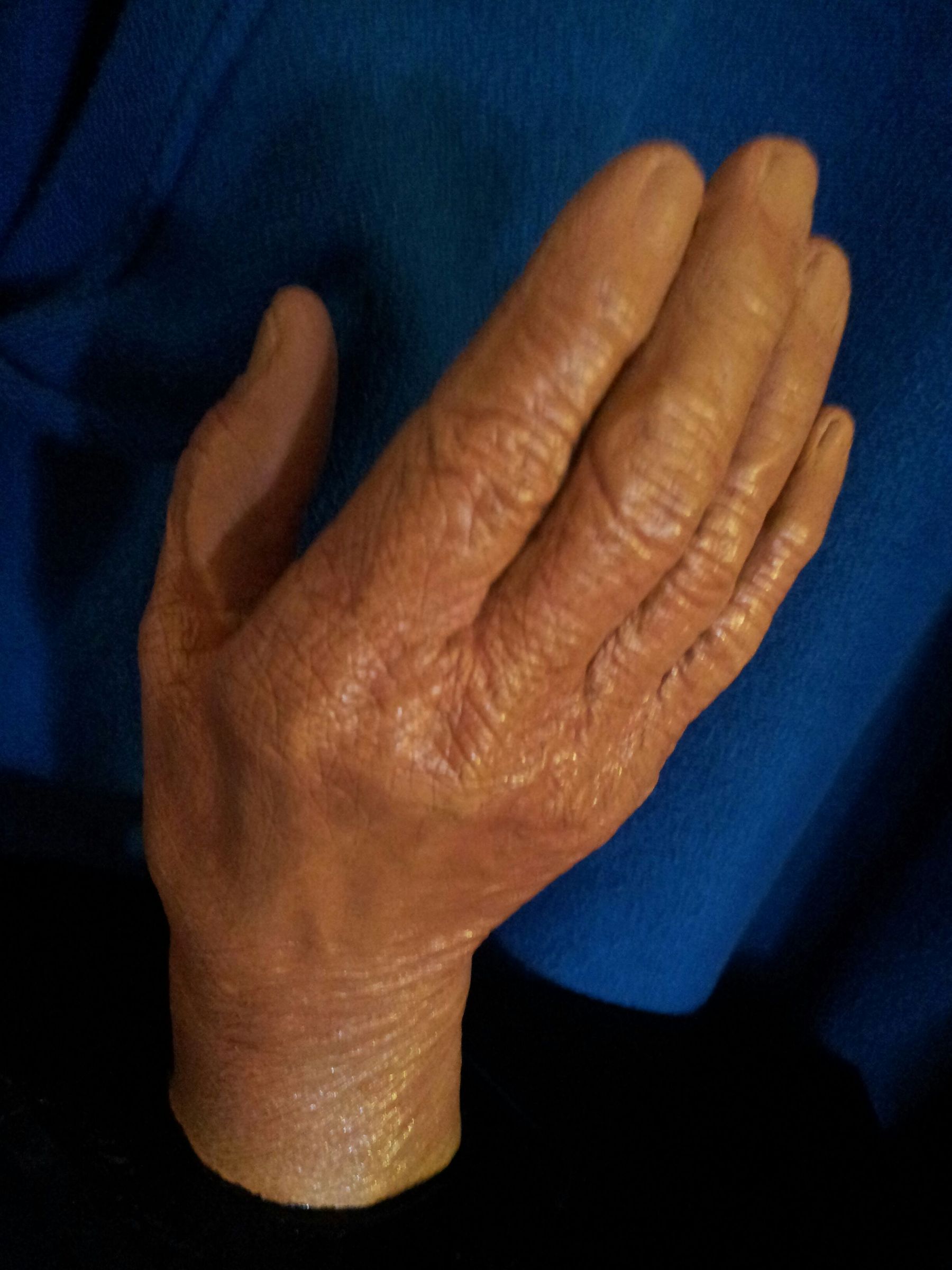 Plaster Alginate Casts of My Hand DIY : 5 Steps (with Pictures ...