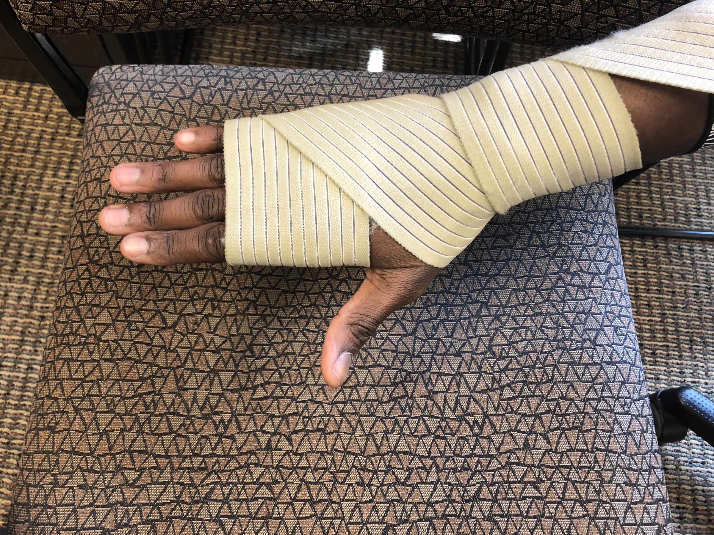 How to Splint Wrist : 10 Steps - Instructables