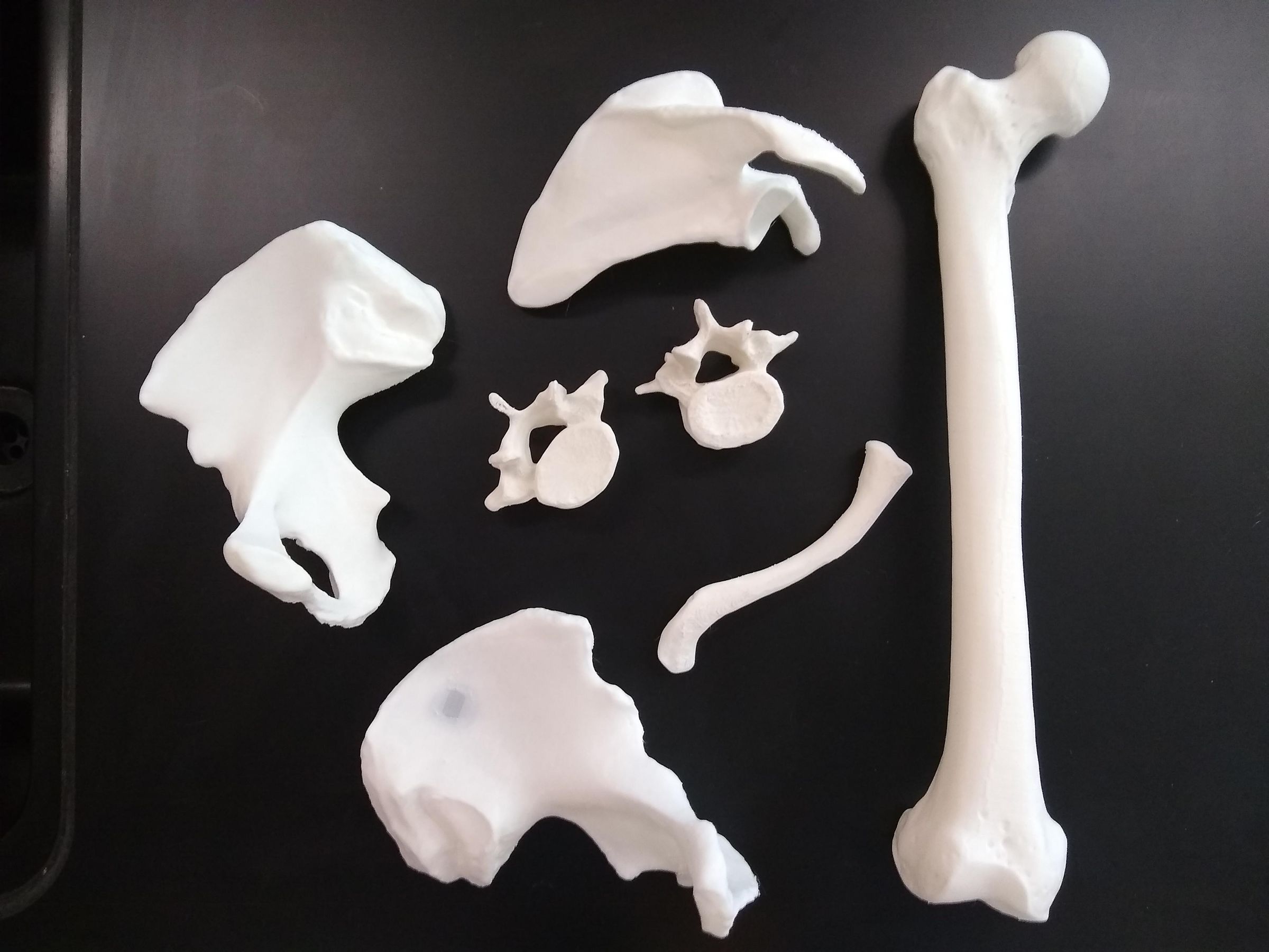 Forensic Anthropology With 3D Printed Bones : 8 Steps (with Pictures ...