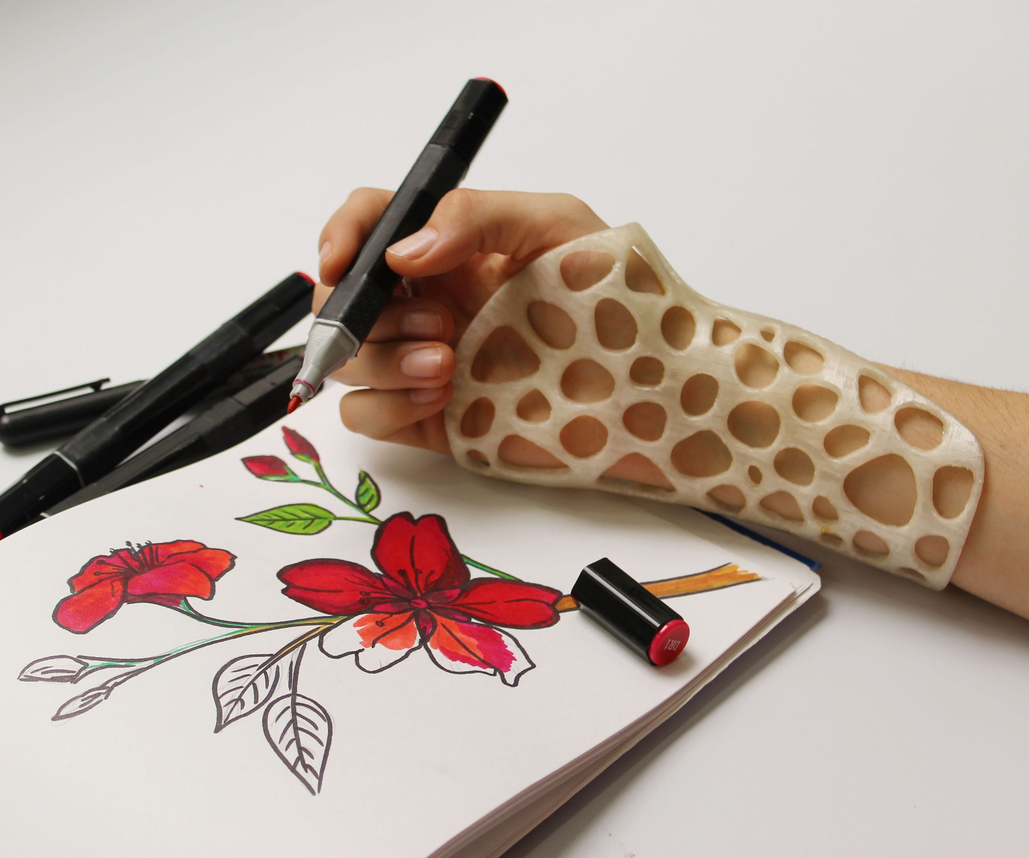 3D Printed Wrist Orthosis : 12 Steps (with Pictures) - Instructables