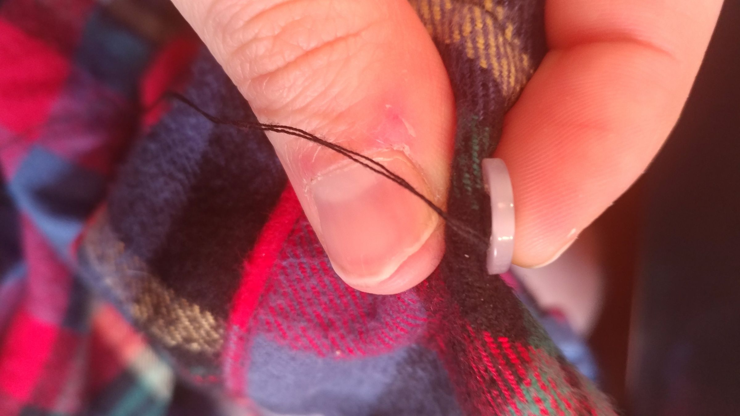 DIY Button Repair : 6 Steps (with Pictures) - Instructables