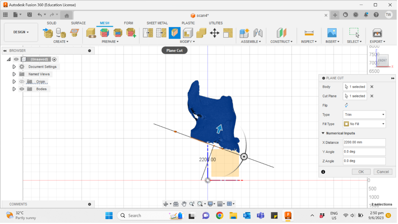 3D Printed Back Brace for Scoliosis : 7 Steps (with Pictures ...