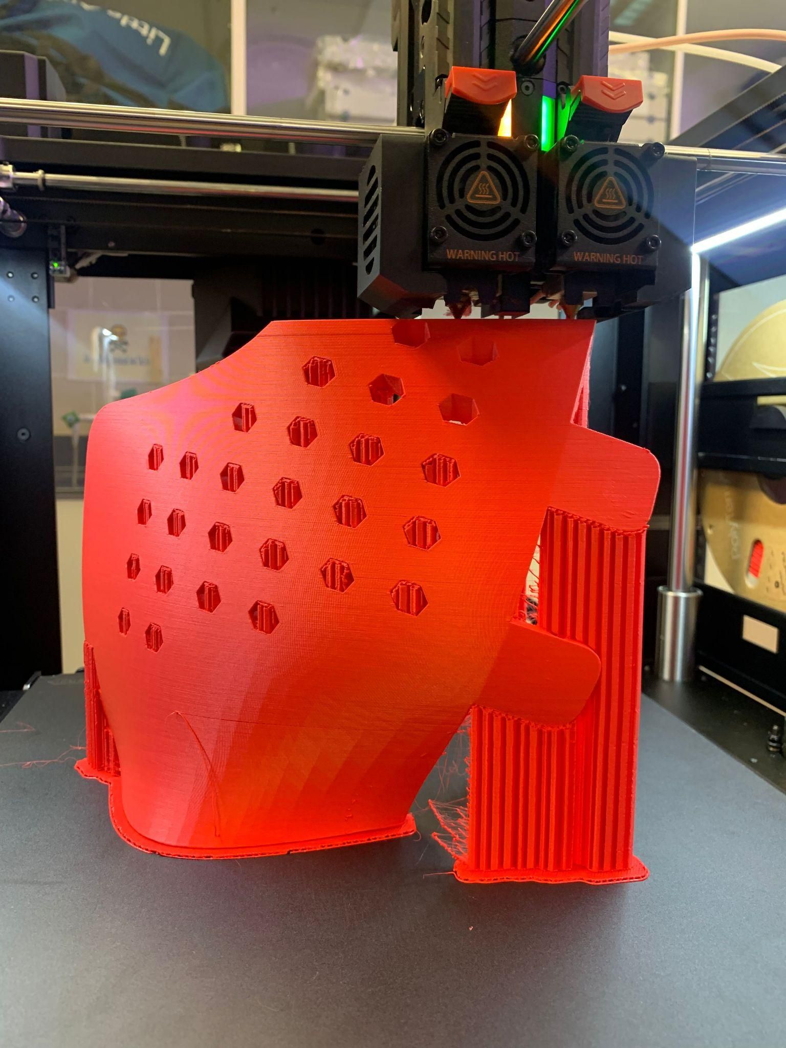 3D Printed Back Brace for Scoliosis : 7 Steps (with Pictures ...
