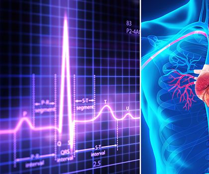 Build Your Own ECG! : 10 Steps - Instructables
