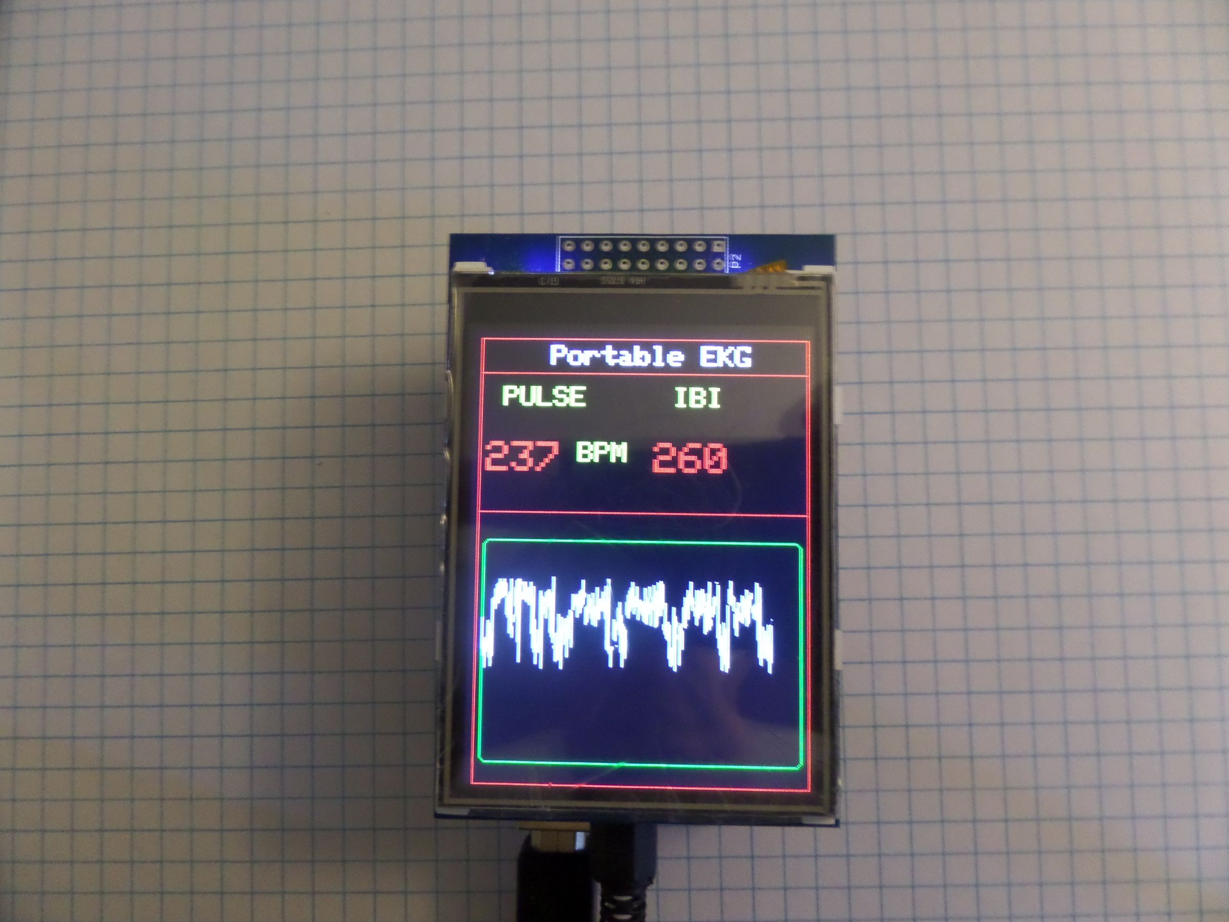 Arduino Portable EKG Monitor : 4 Steps (with Pictures) - Instructables