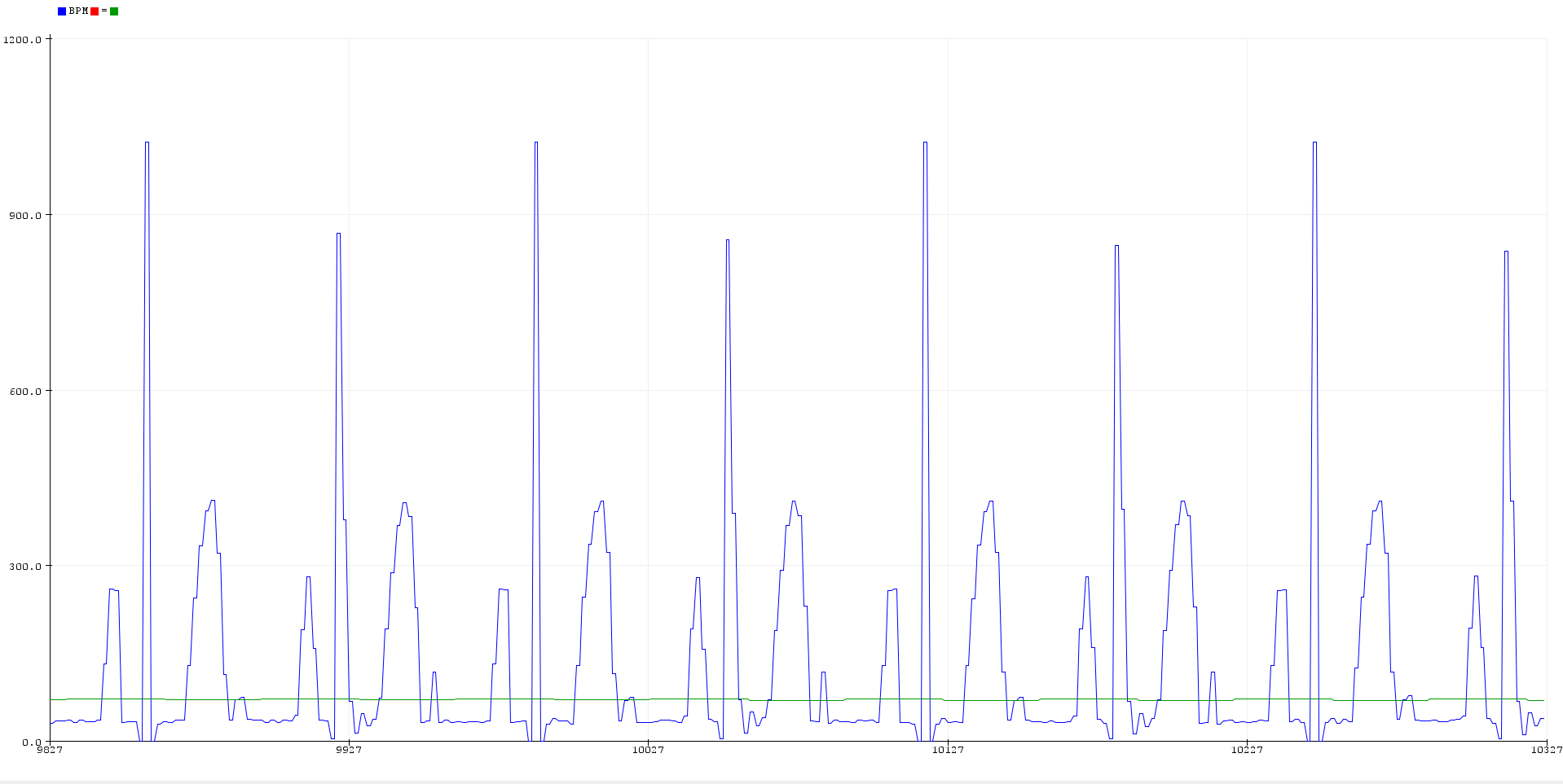 Designing a Functional ECG With Arduino Output : 7 Steps - Instructables
