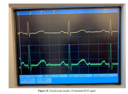 Introduction to Functional ECG Circuit : 8 Steps - Instructables