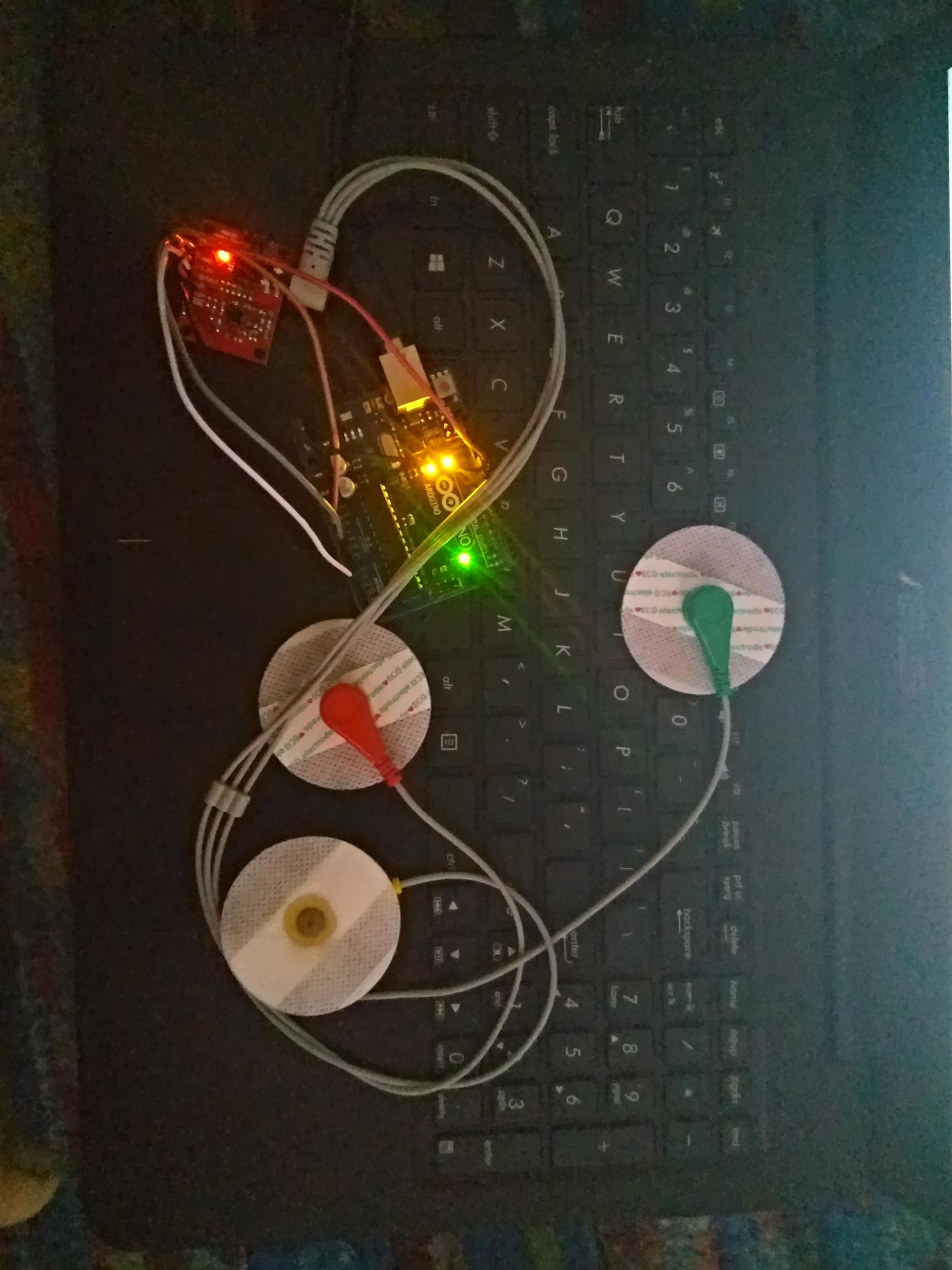 Arduino Based ECG & Heartbeat Monitoring Healthcare System : 8 Steps ...