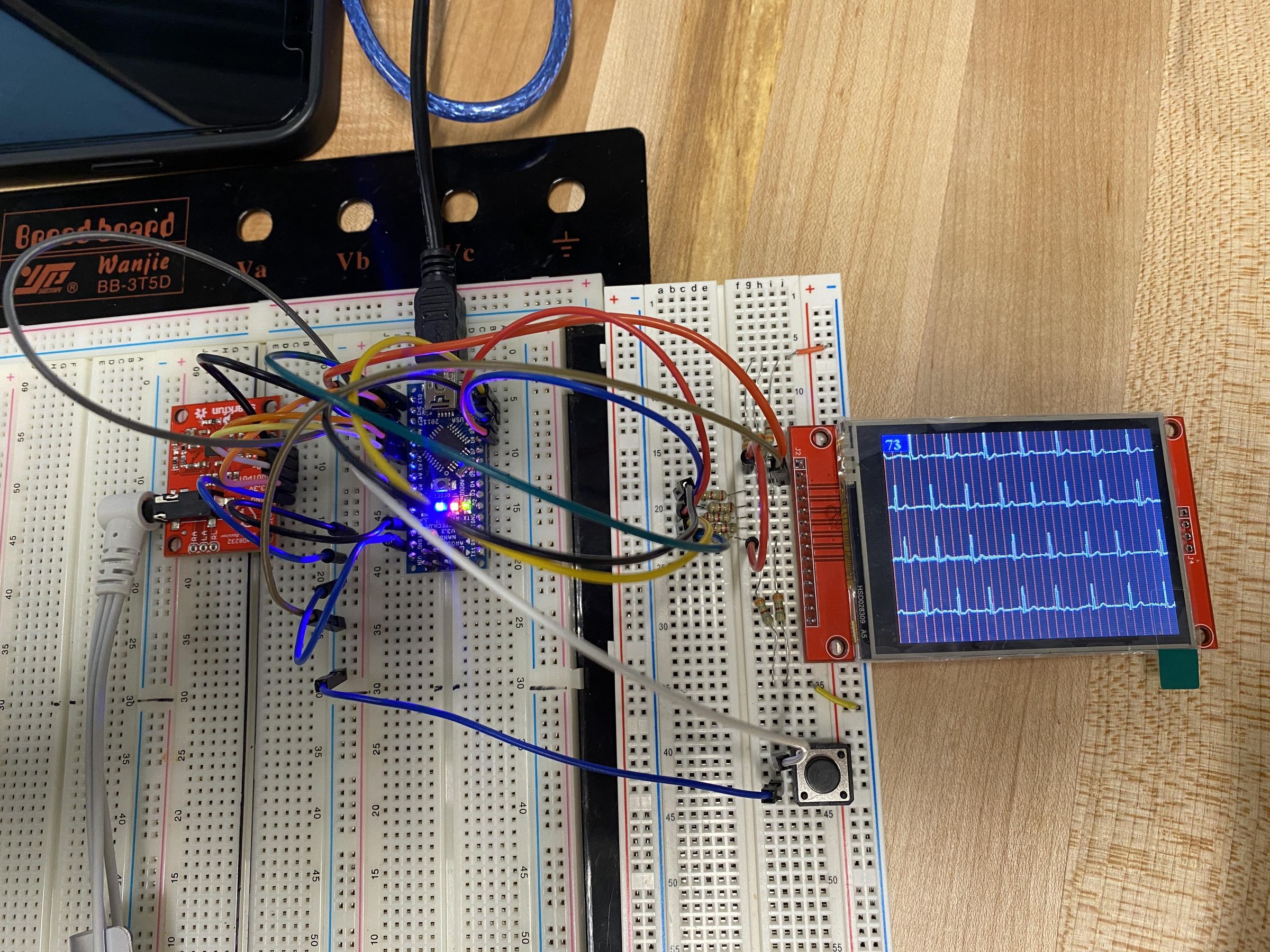 ECG Display With Arduino : 13 Steps (with Pictures) - Instructables
