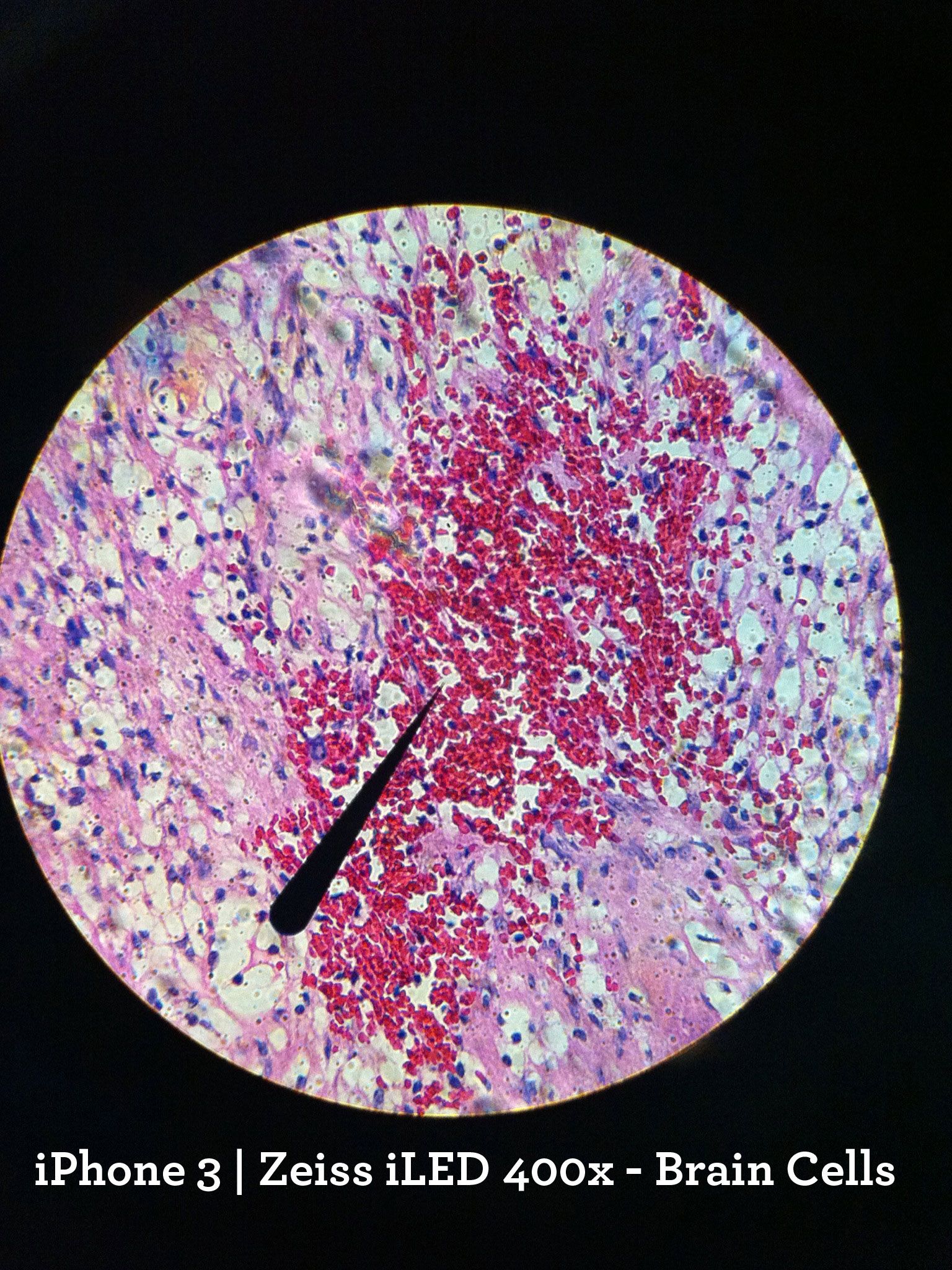 How to Turn Your IPhone Into a Microscope or Spotting Scope Eyepiece ...