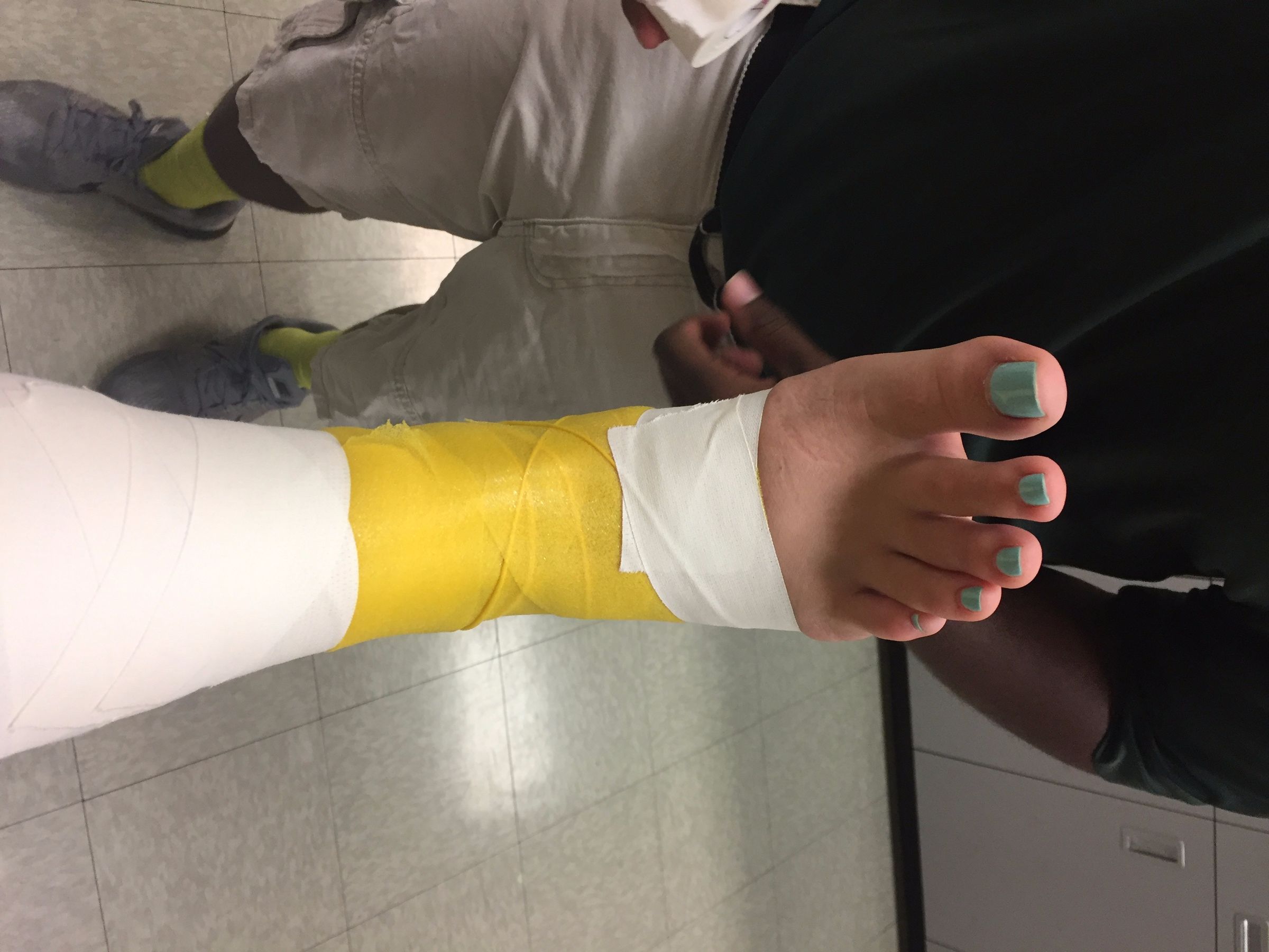 Ankle Taping : 8 Steps (with Pictures) - Instructables