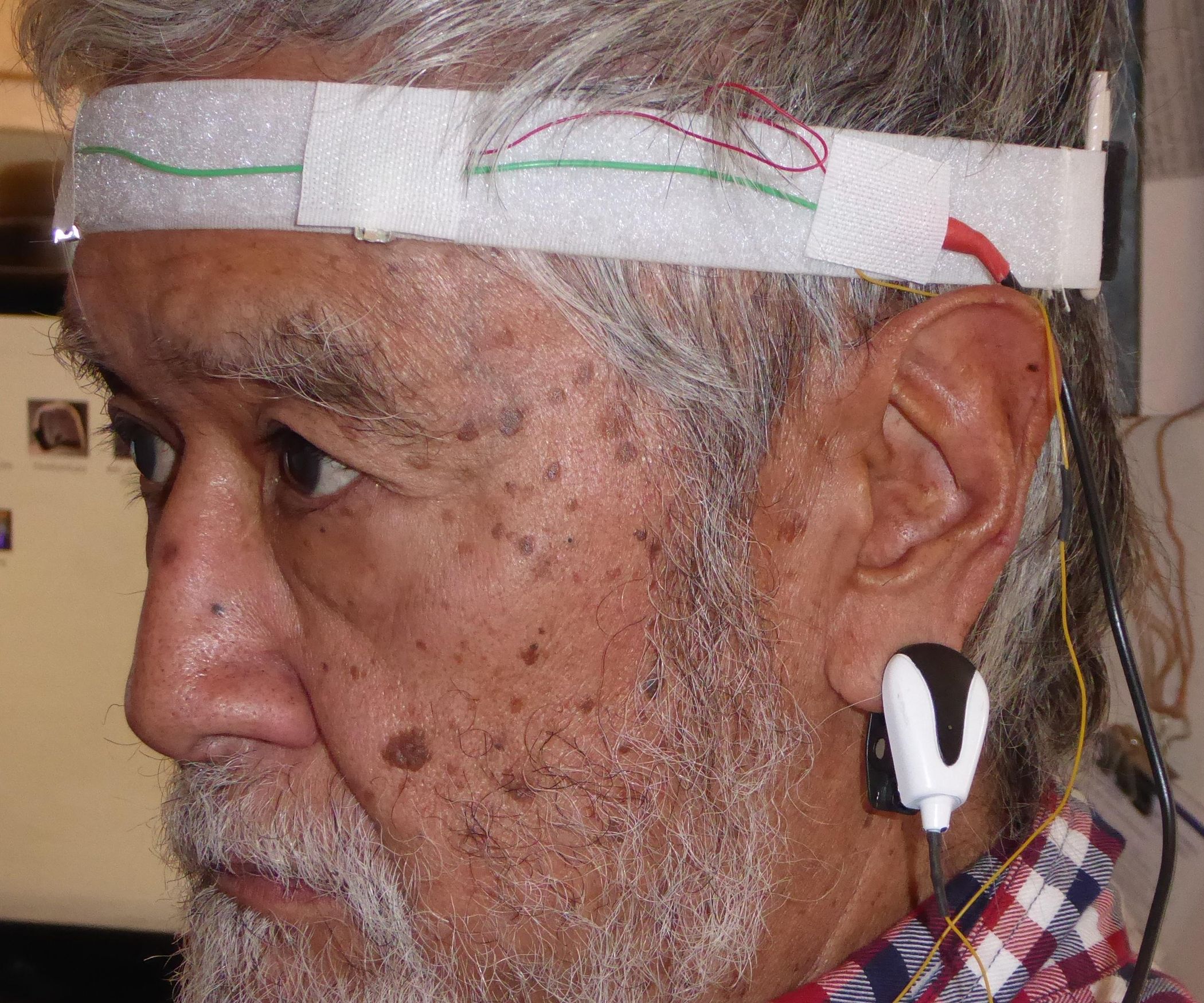 EEG AD8232 Phase 2 : 5 Steps (with Pictures) - Instructables