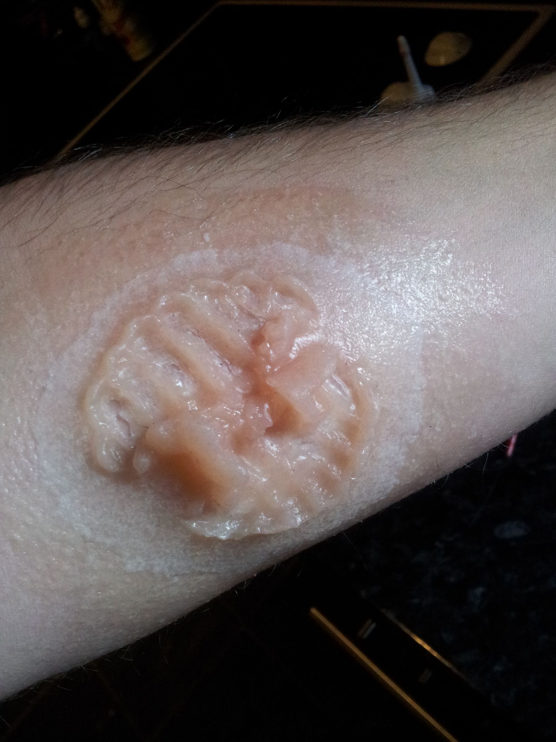 Walking Dead Style Zombie Bite Wound Application How To : 9 Steps ...