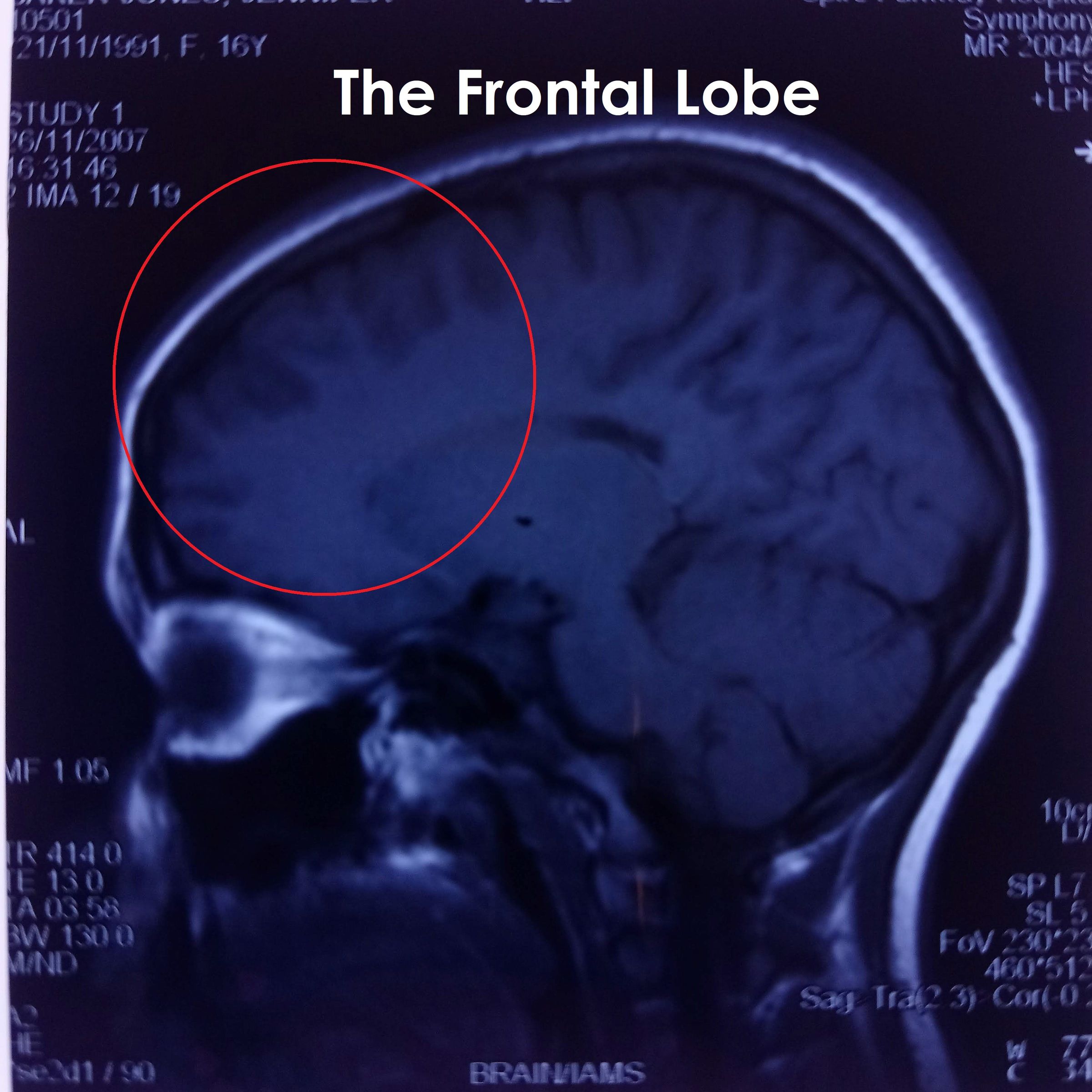 Mapping Your Mind- a Lesson on the Human Brain : 7 Steps - Instructables