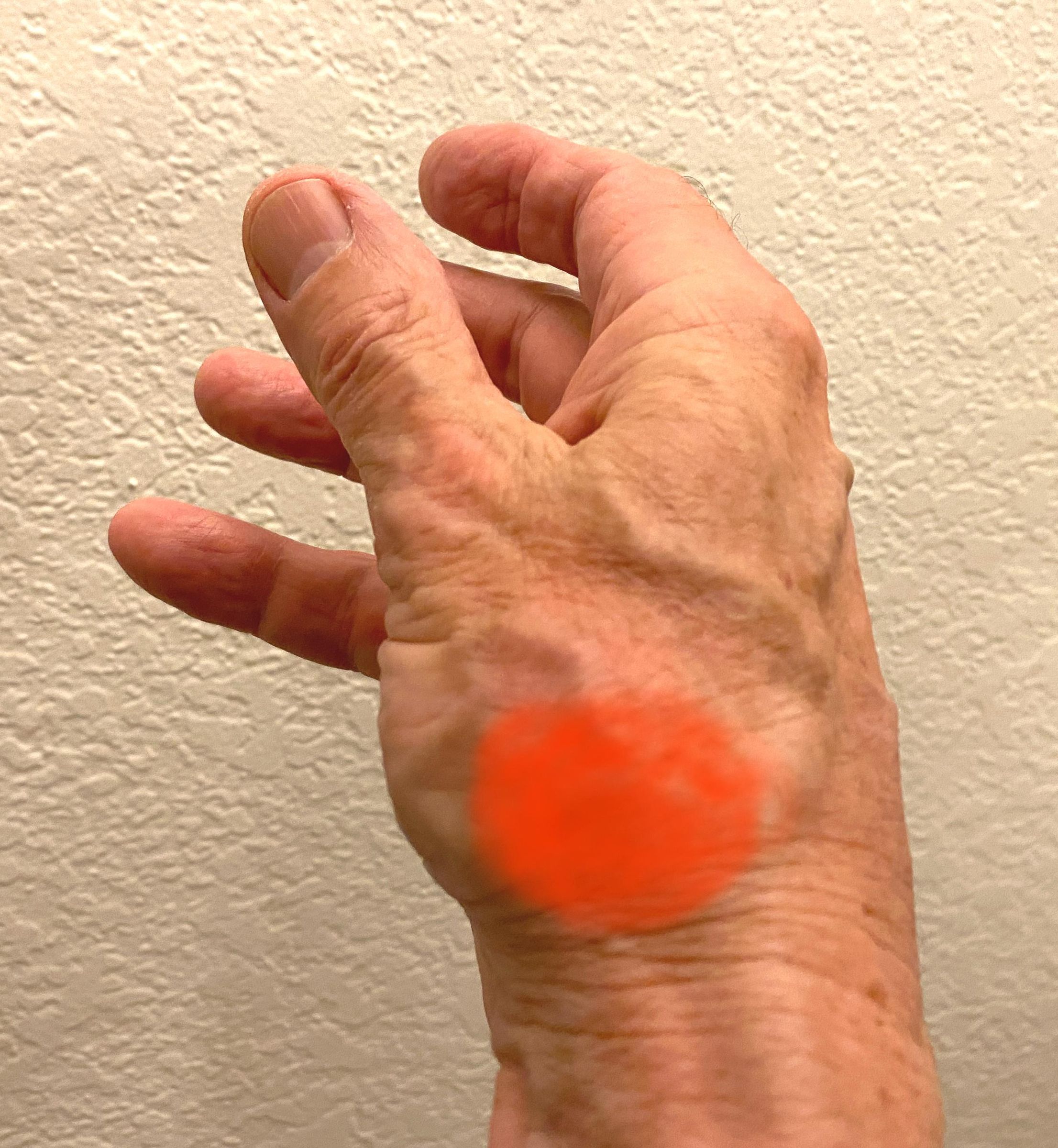 Make a Splint for Your Sore Thumb Joint : 10 Steps (with Pictures ...