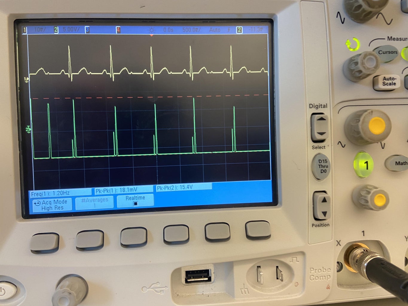 Design A Functional Ecg With Automated Plotting Of The Biosignal 6 Steps Instructables