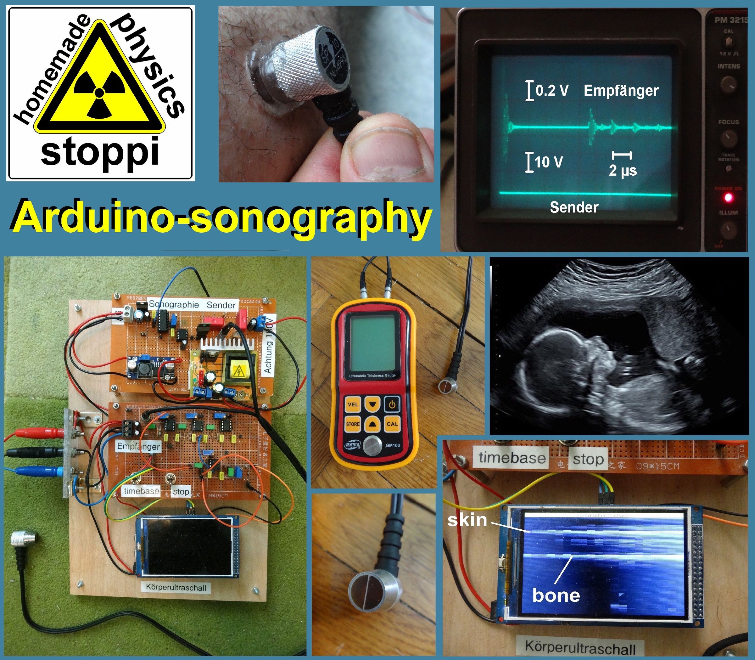 Body-ultrasound Sonography With Arduino : 3 Steps (with Pictures ...