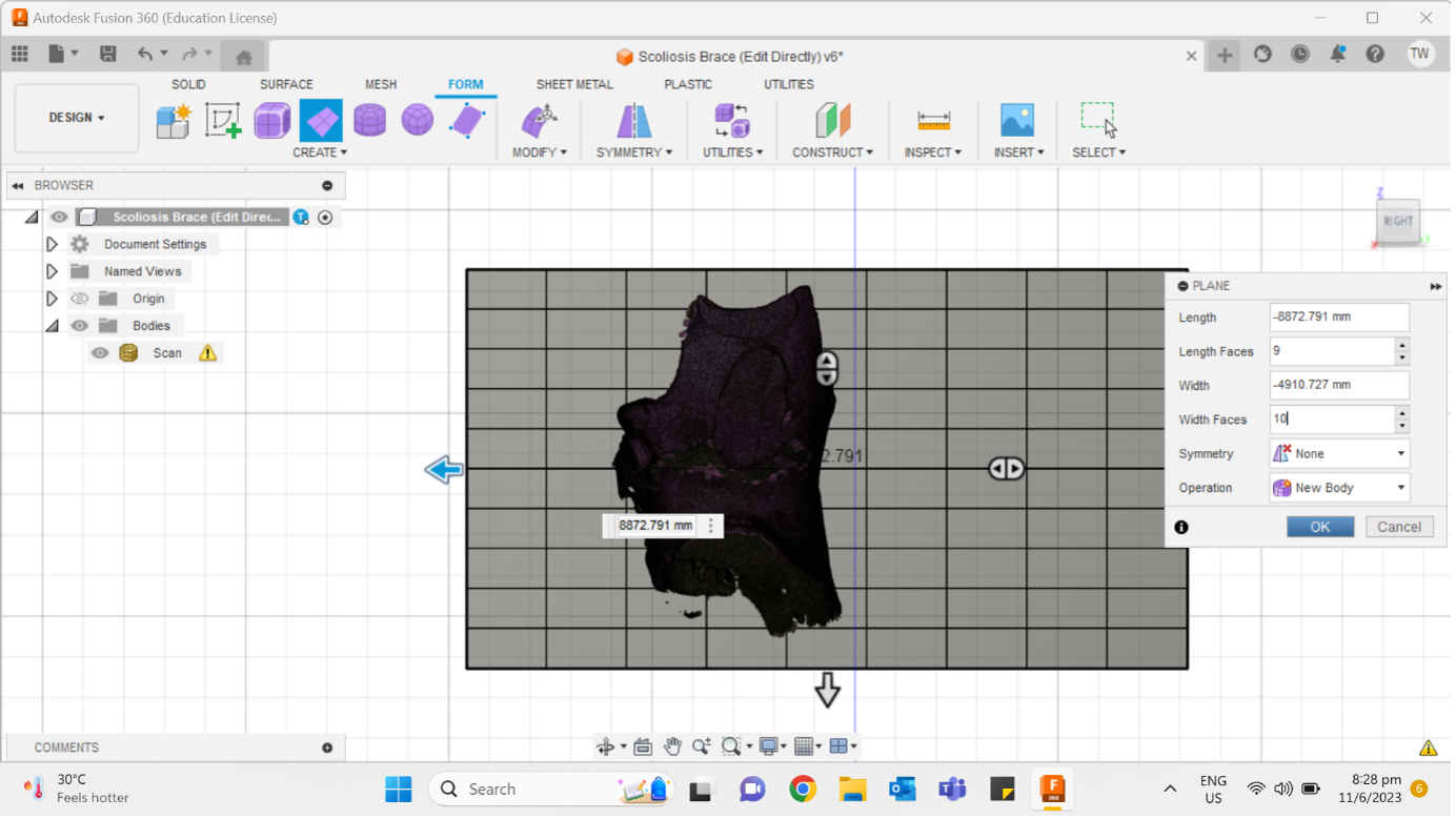 3D Printed Back Brace for Scoliosis : 7 Steps (with Pictures ...
