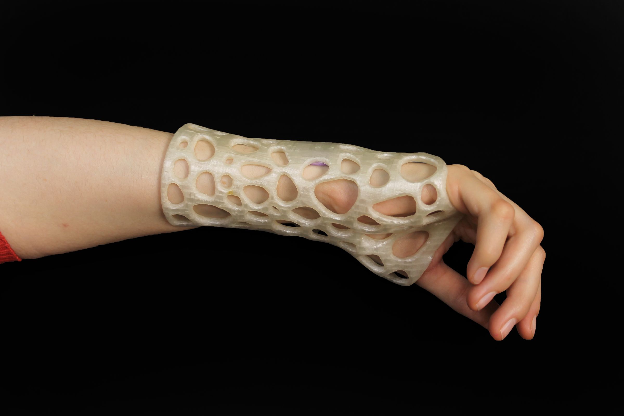 3D Printed Wrist Orthosis : 12 Steps (with Pictures) - Instructables