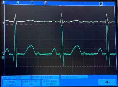 Functional ECG Circuit Design Project : 8 Steps - Instructables