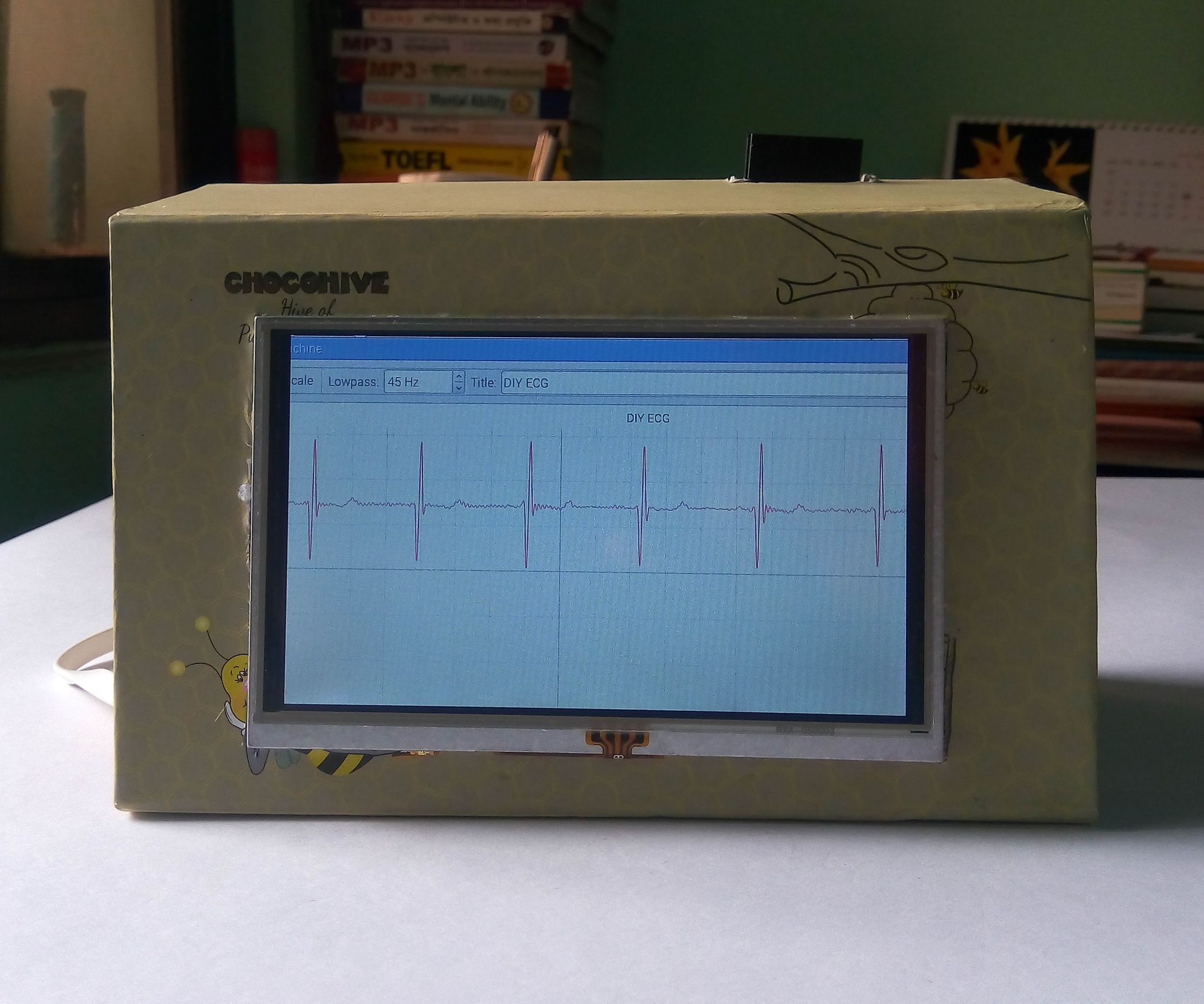 Portable ECG Machine : 9 Steps (with Pictures) - Instructables