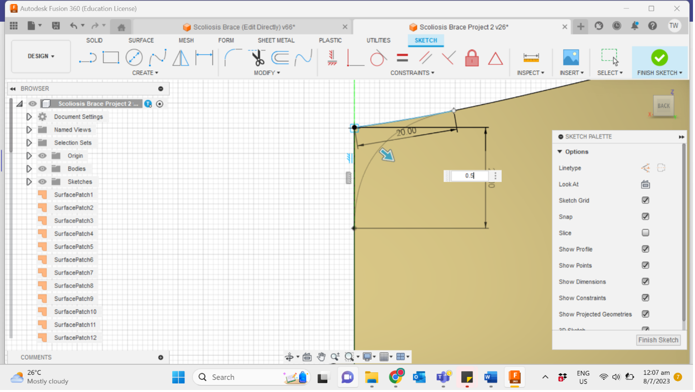3D Printed Back Brace for Scoliosis : 7 Steps (with Pictures ...