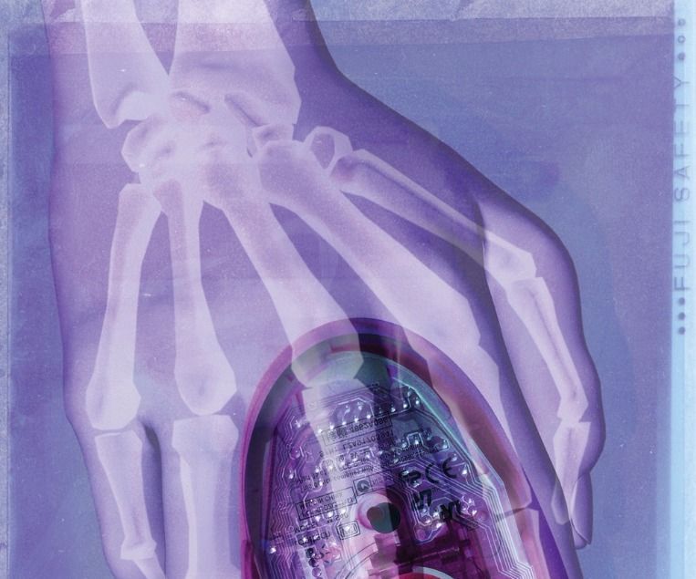 X-ray Effects : 15 Steps - Instructables