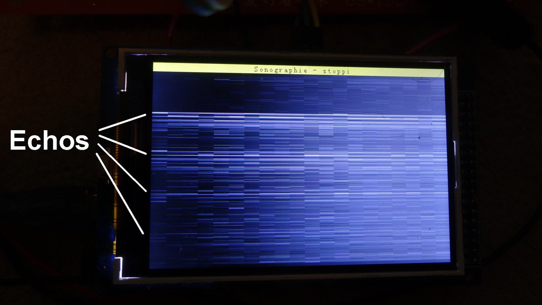 Body Ultrasound Sonography With Arduino 3 Steps With Pictures
