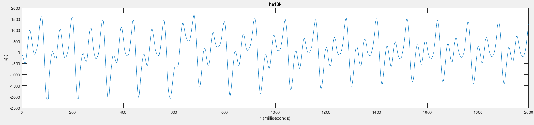 Detachable Guitar Auto Tuner : 6 Steps (with Pictures) - Instructables