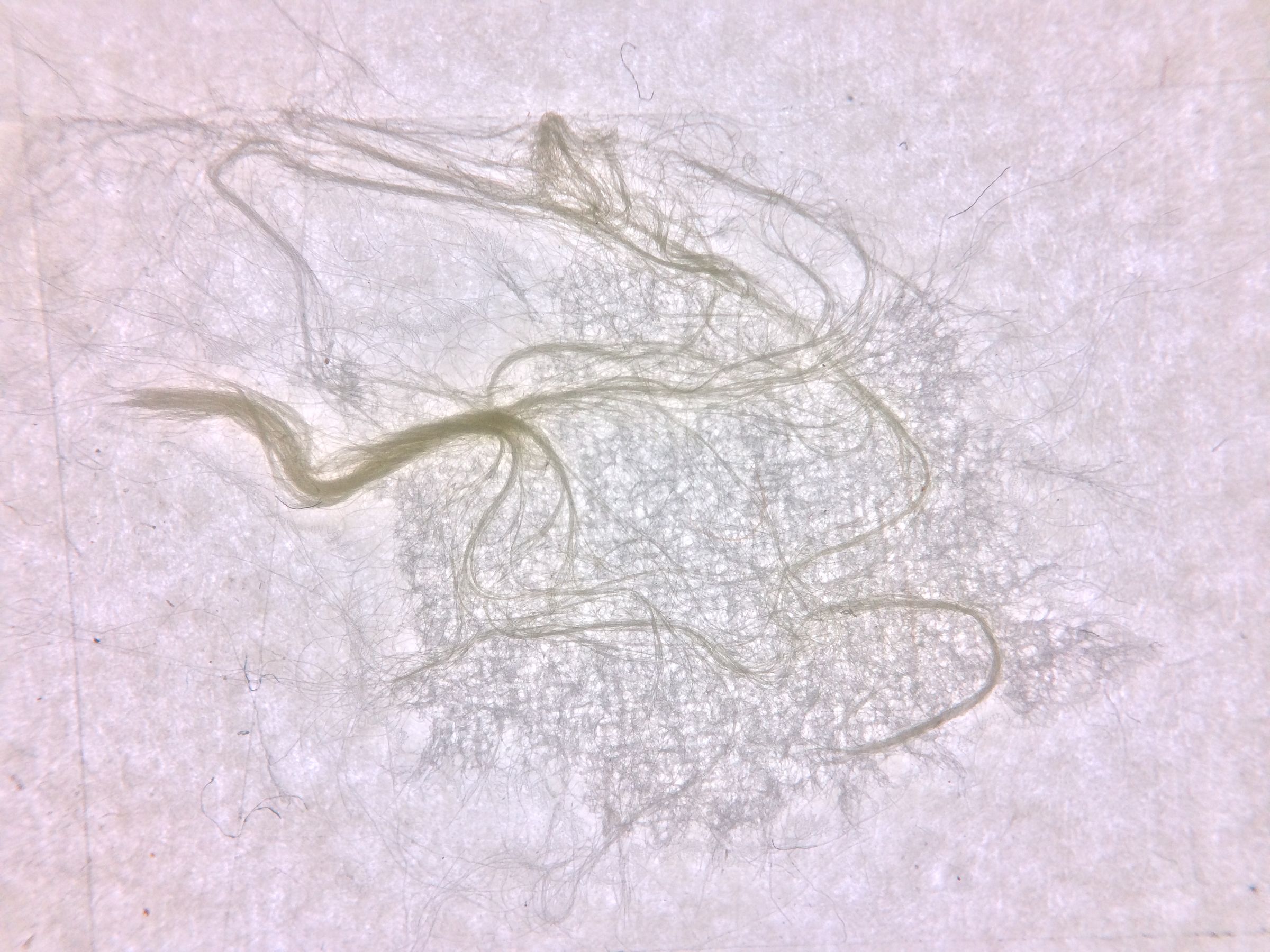 Low-cost Fluorescence and Brightfield Microscopes : 9 Steps (with ...