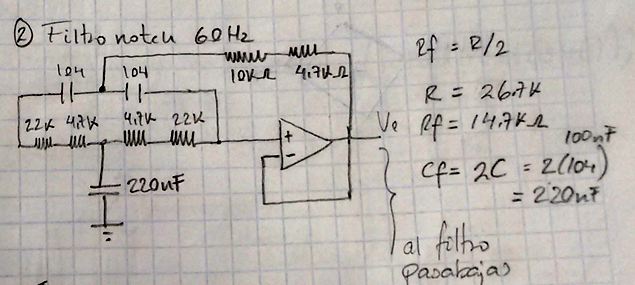 DIY ECG + Arduino + LabView : 8 Steps - Instructables