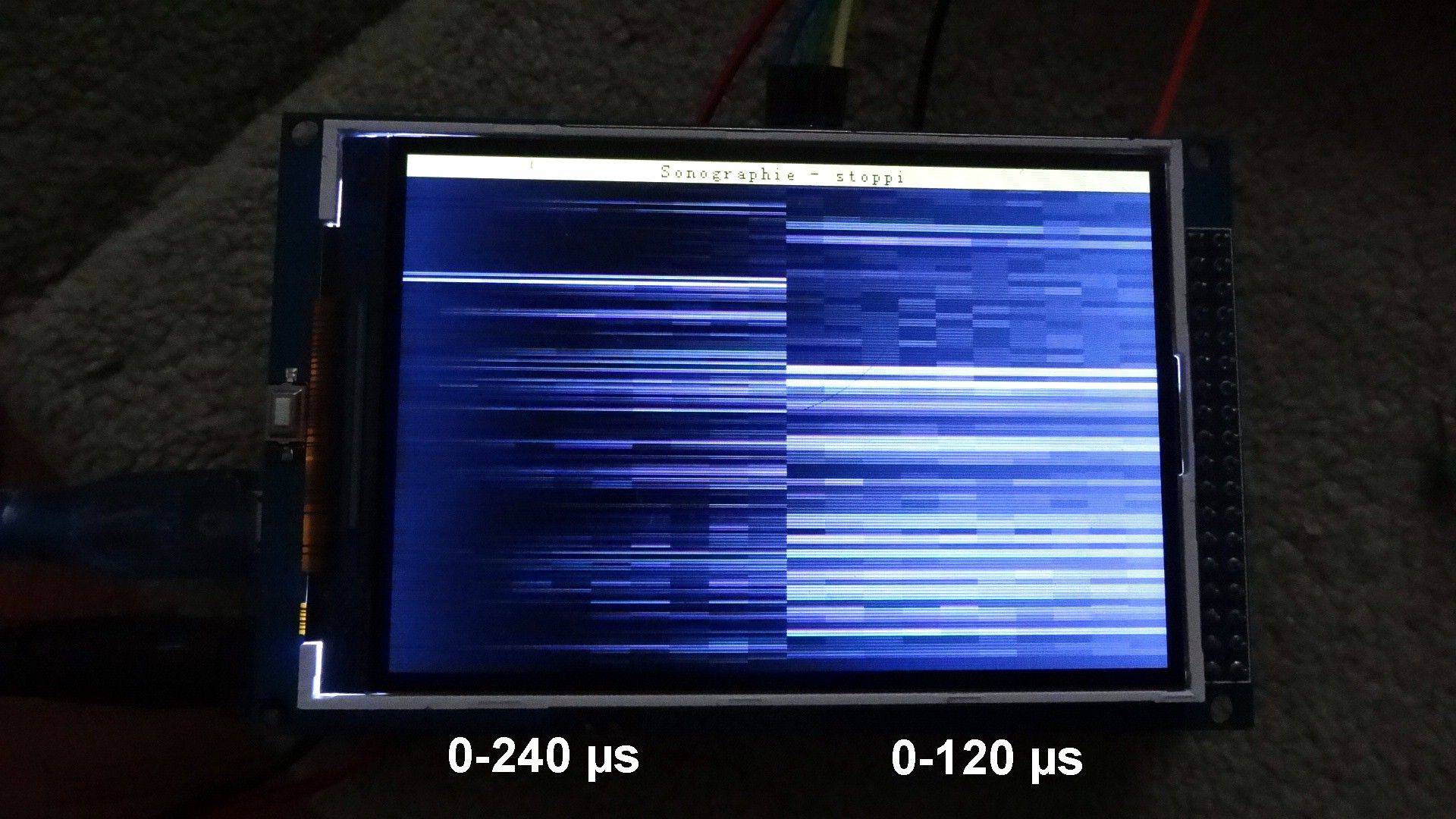 Body-ultrasound Sonography With Arduino : 3 Steps (with Pictures) - Instructables