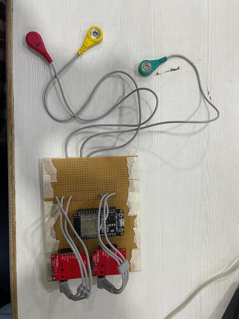 Arduino Based ECG & Heartbeat Monitoring Healthcare System : 8 Steps ...