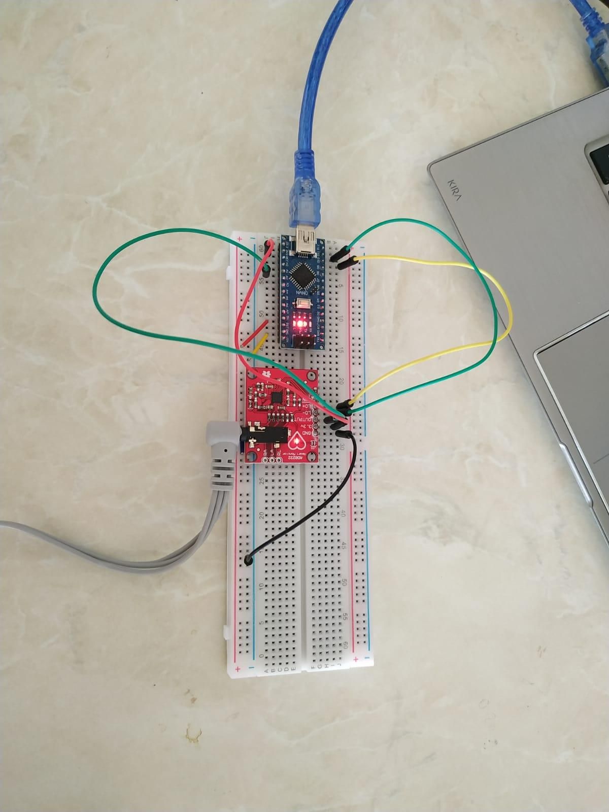 Arduino Based ECG & Heartbeat Monitoring Healthcare System : 8 Steps ...