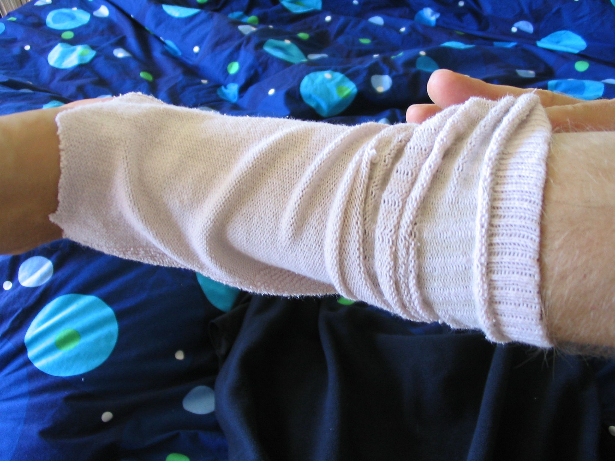 Sock Arm Bandage : 6 Steps - Instructables