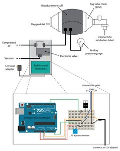 DIY Ventilator Using Common Medical Supplies : 8 Steps - Instructables