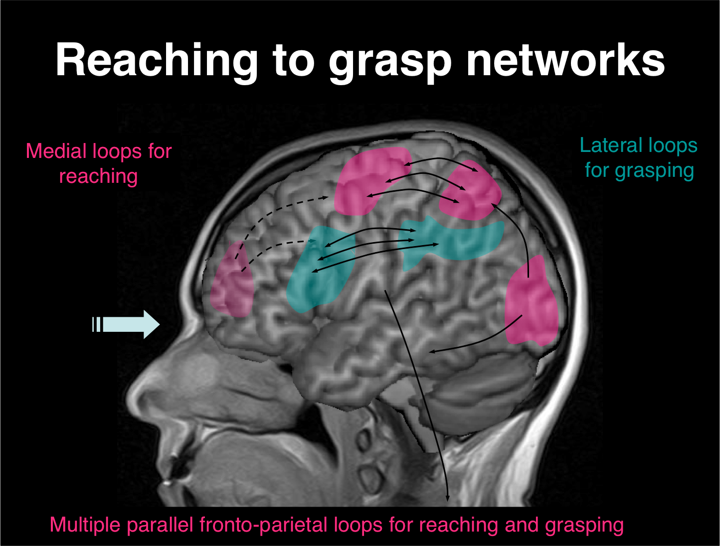 3D Printing MRI Compatible Tools for Apraxia Study : 3 Steps (with ...