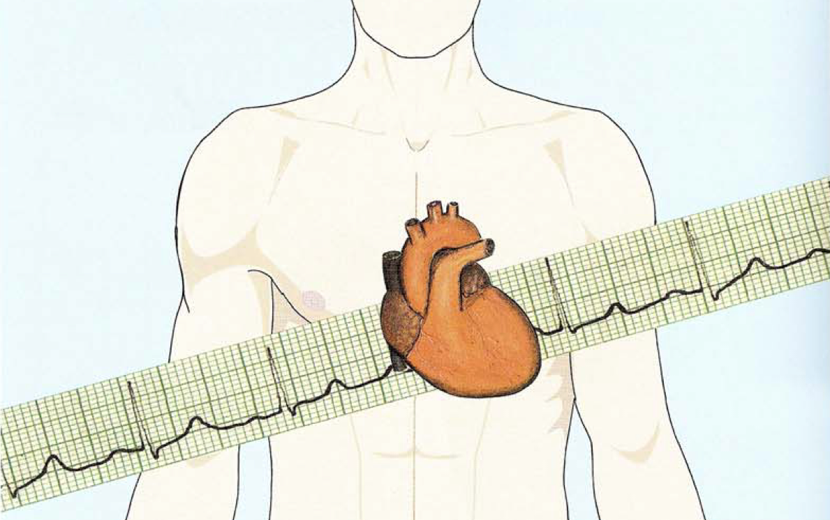 The Do-It-Yourself Electrocardiogram (ECG) : 6 Steps - Instructables