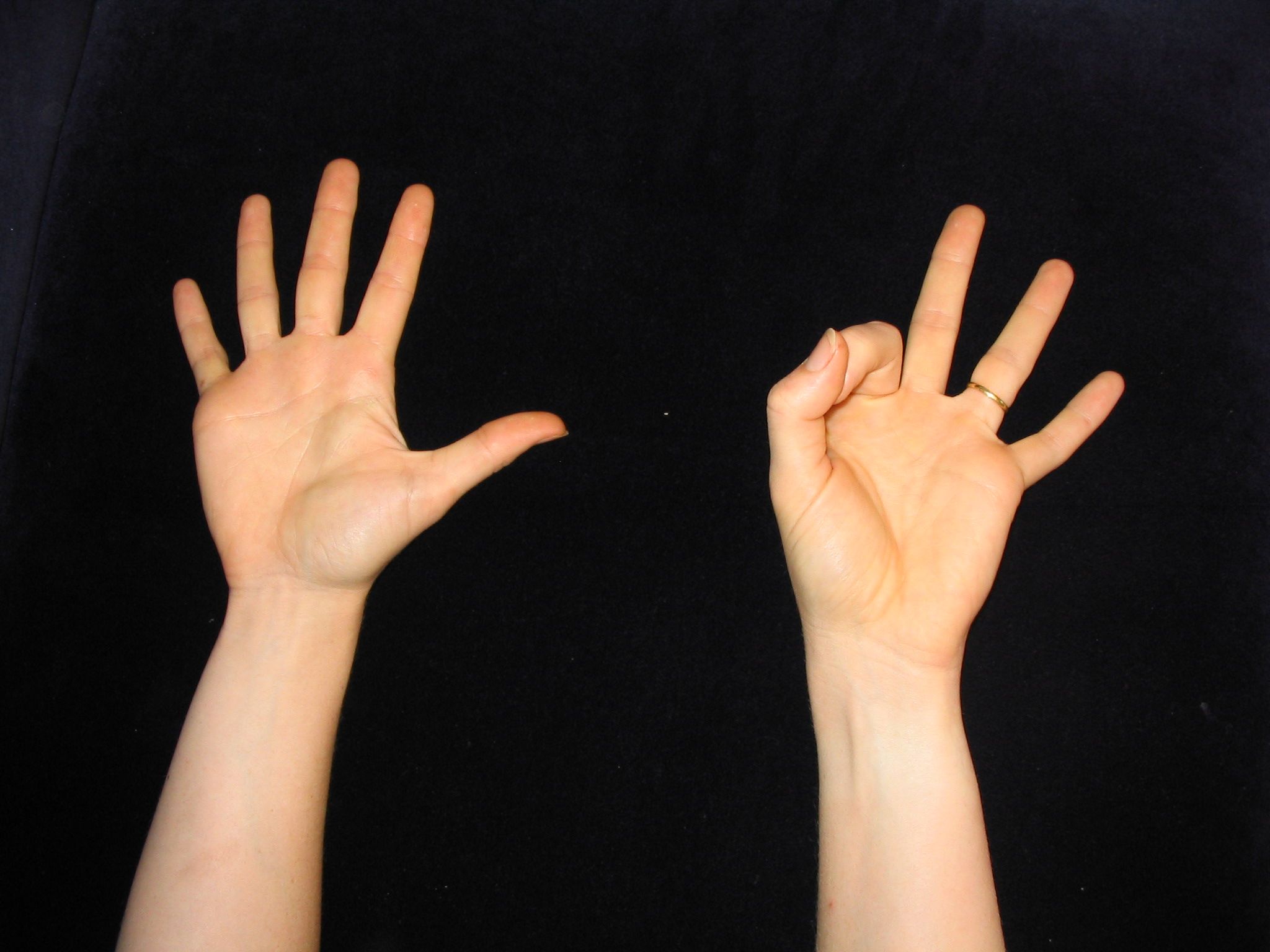 Mouse Toe Numbering Scheme : 5 Steps - Instructables