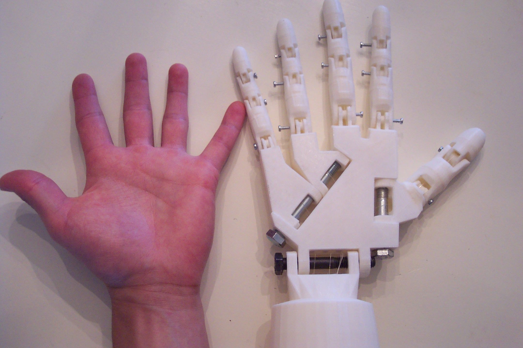 DIY Prosthetic Hand & Forearm (Voice Controlled) : 14 Steps (with ...