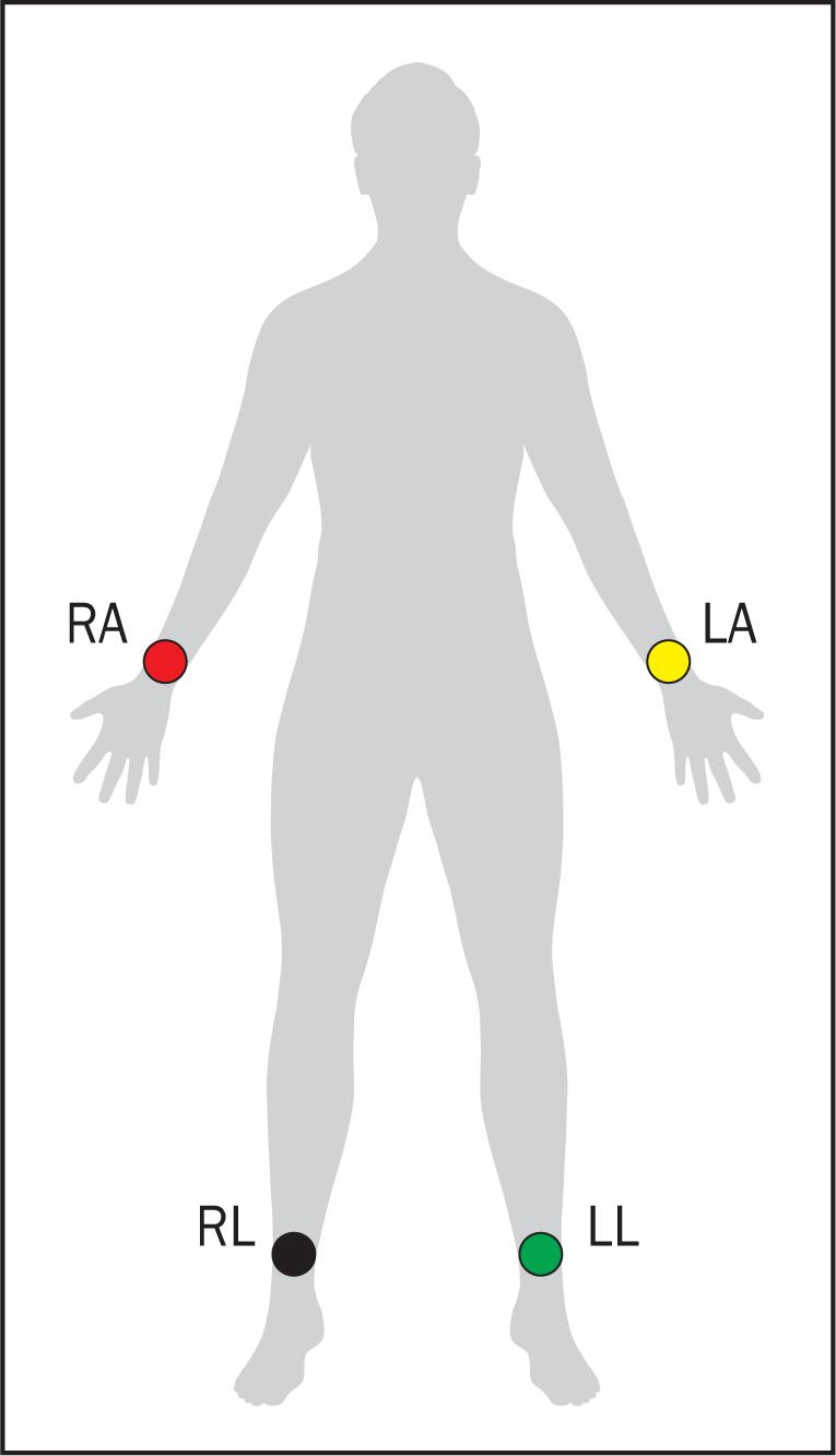 How to Make an Electrocardiogram (ECG) : 7 Steps - Instructables