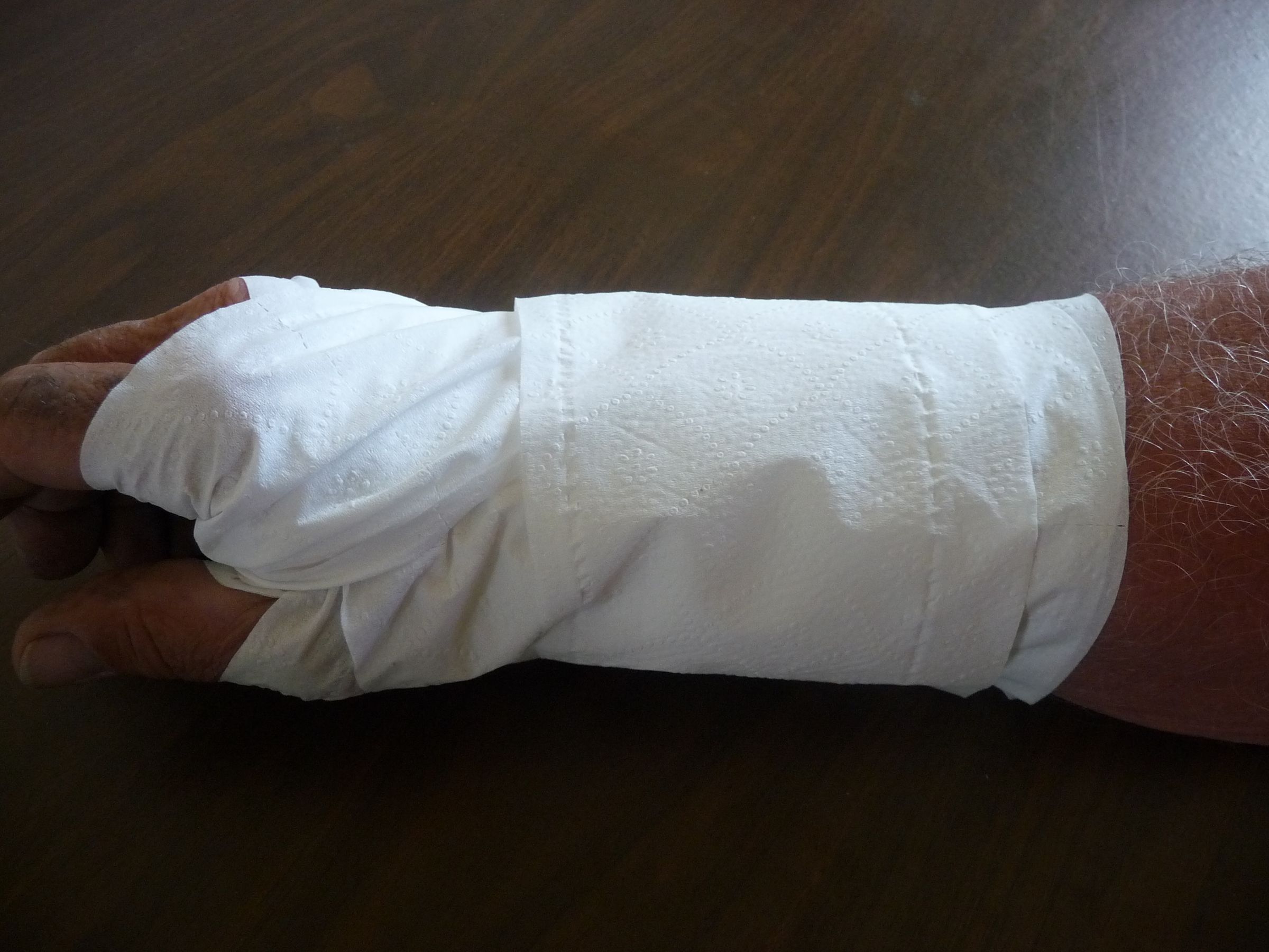 DIY Soft Cast Using Duct Tape - Instructables